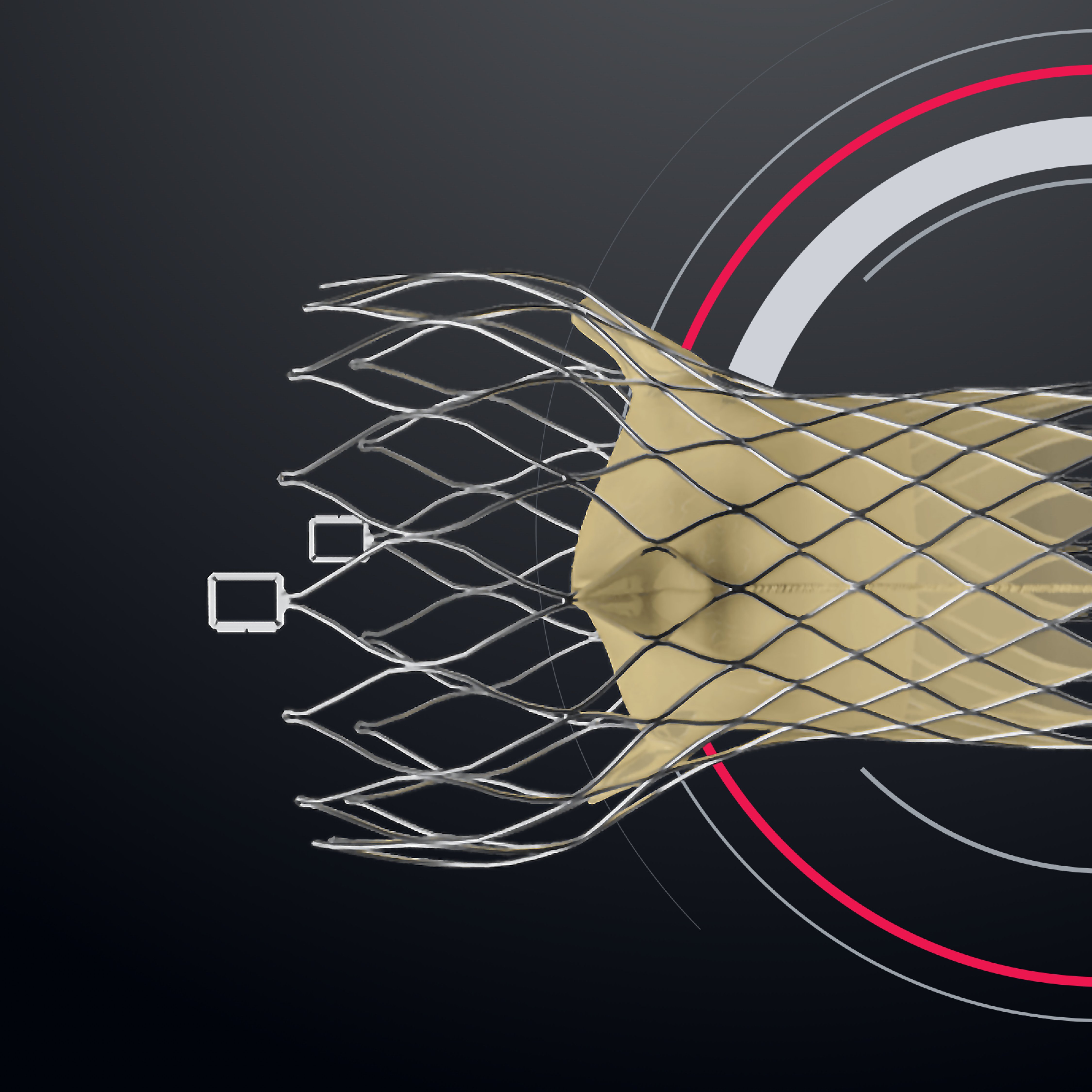 Advancing Structural Heart Solutions with MP35N | Carpenter Technology